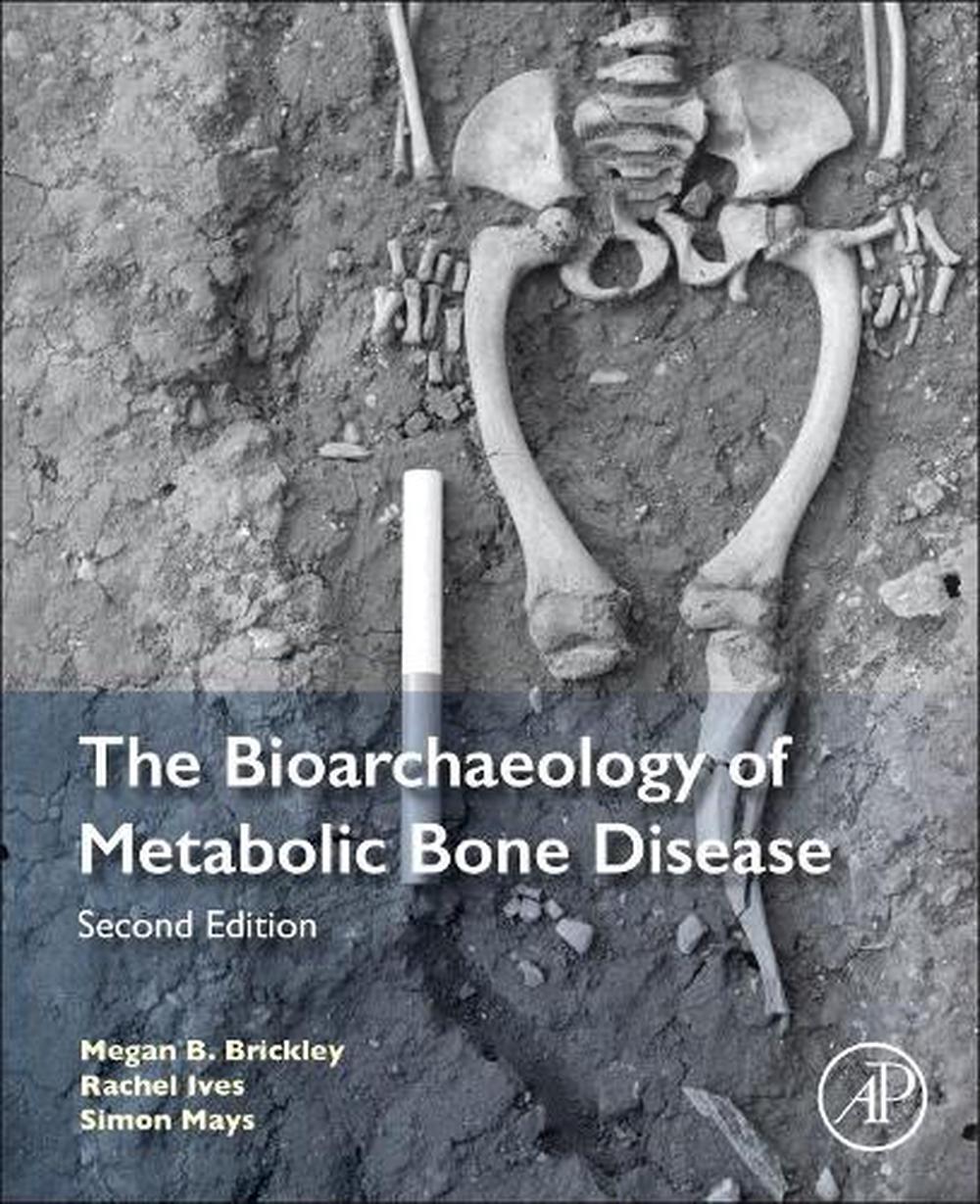 The Bioarchaeology of Metabolic Bone Disease by Rachel Ives, Paperback ...