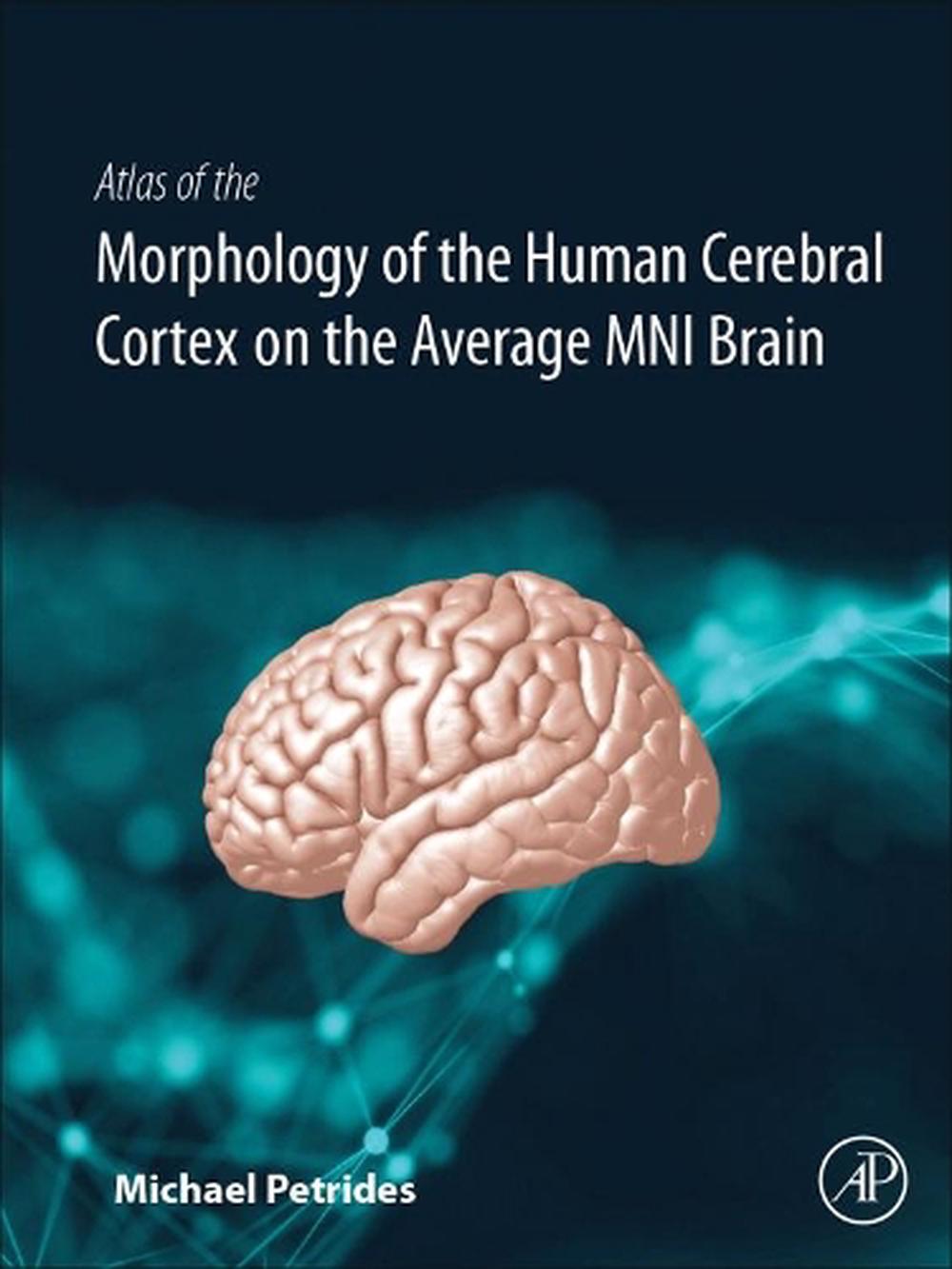 Atlas of the Morphology of the Human Cerebral Cortex on the Average MNI ...