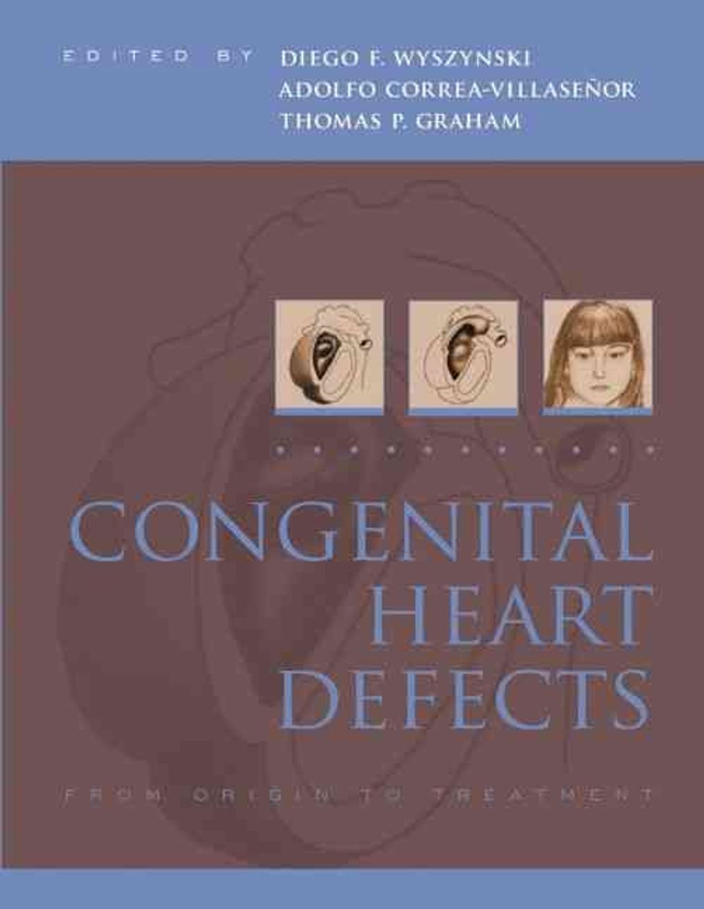Congenital Heart Defects by Diego Wyszynski, Hardcover, 9780195373882 ...