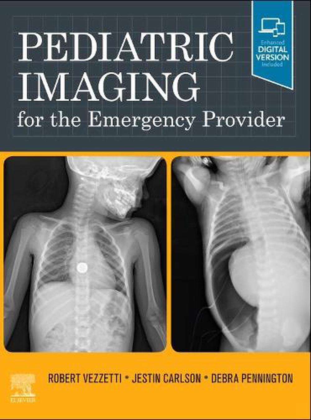 Pediatric Imaging for the Emergency Provider by Vezzetti, Hardcover ...