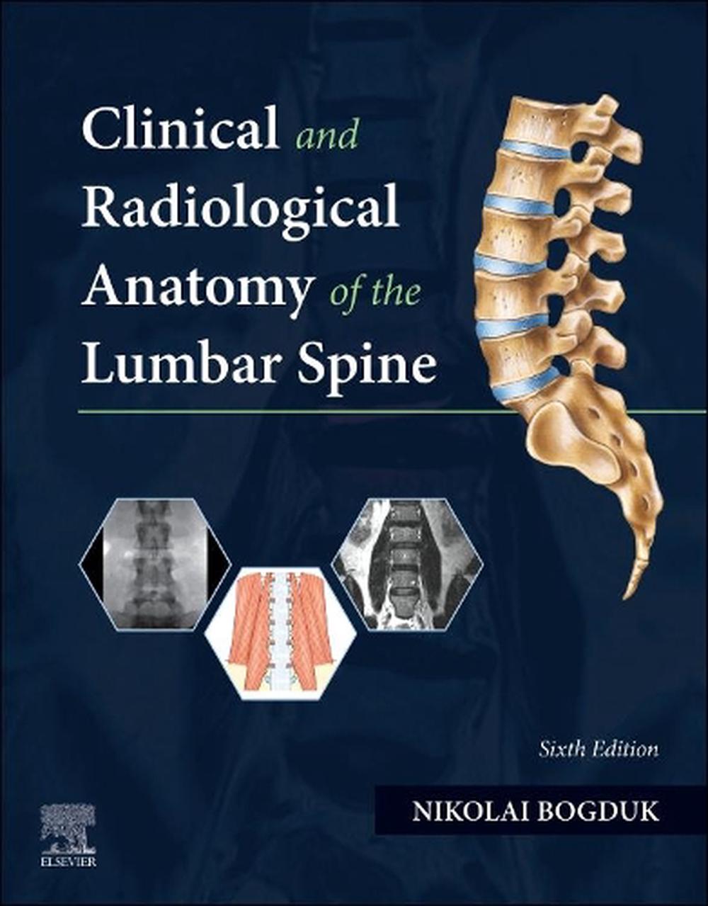 Clinical and Radiological Anatomy of the Lumbar Spine, 6th Edition by ...