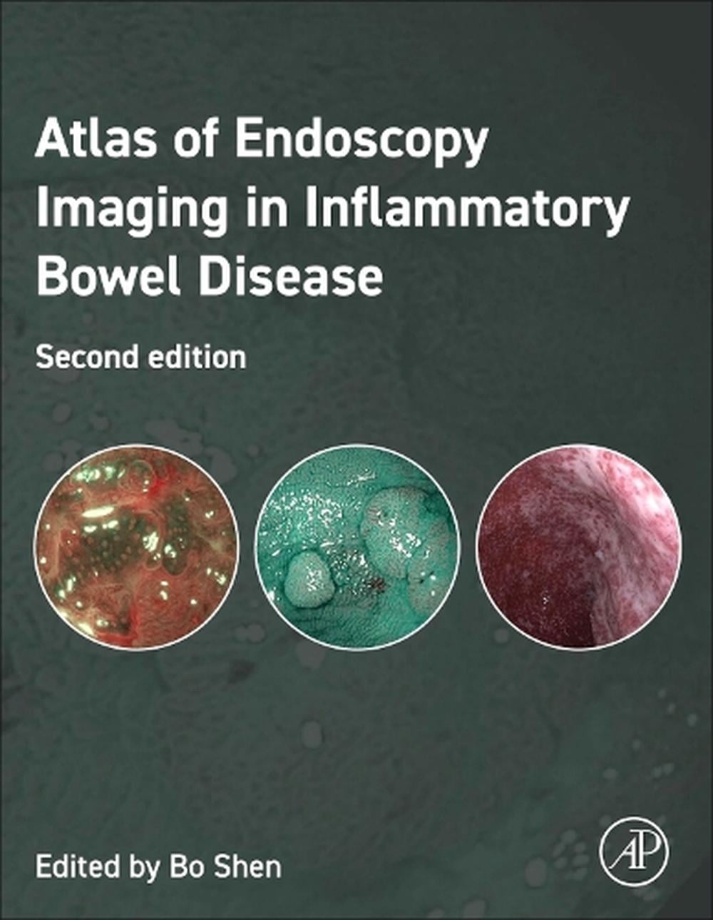 Atlas of Endoscopy Imaging in Inflammatory Bowel Disease, 2nd Edition ...