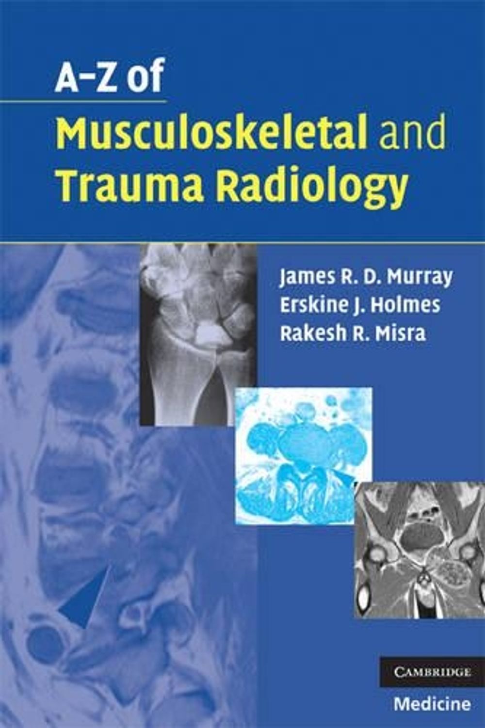 A-Z of Musculoskeletal and Trauma Radiology by Erskine J. Holmes ...