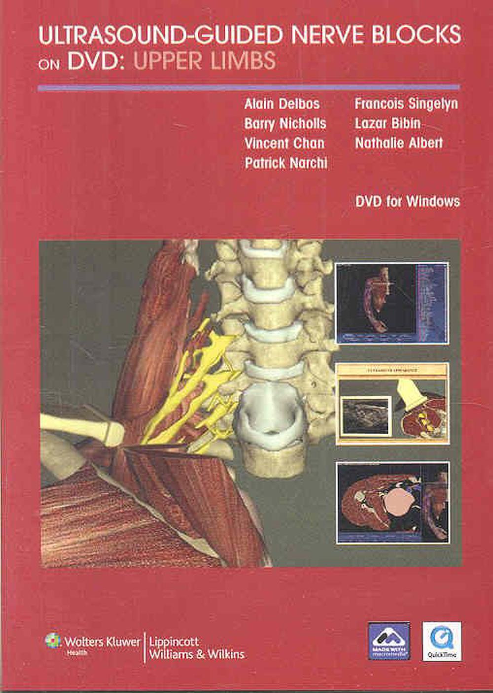 Ultrasound-Guided Nerve Blocks on DVD Set of 2 DVDs by Delbos ...