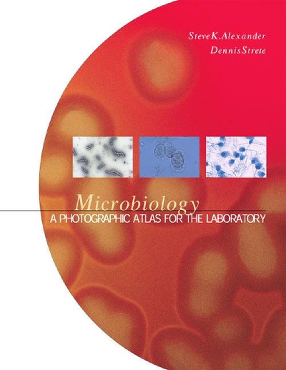 MICROBIOLOGY by Dennis Strete, Spiral, 9780805327328 | Buy online at ...
