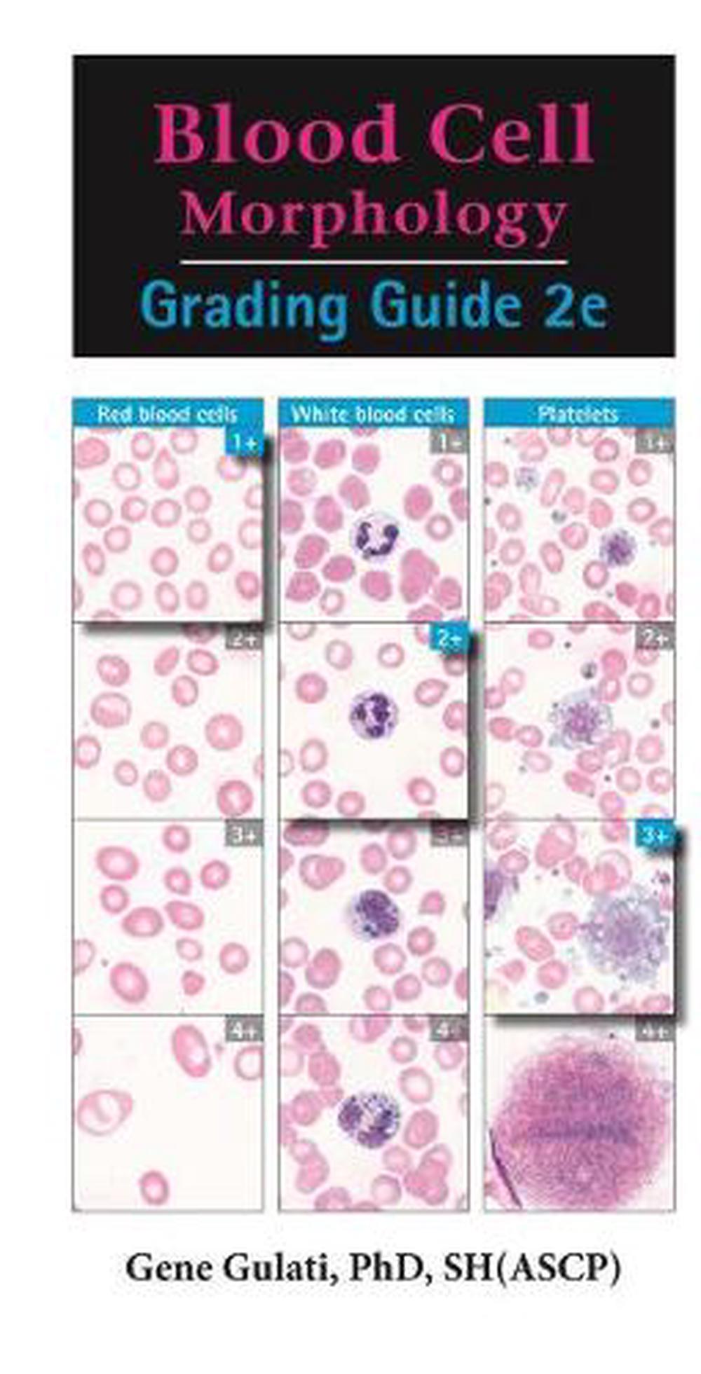 Blood Cell Morphology Grading Guide by Gene Gulati, Spiral ...