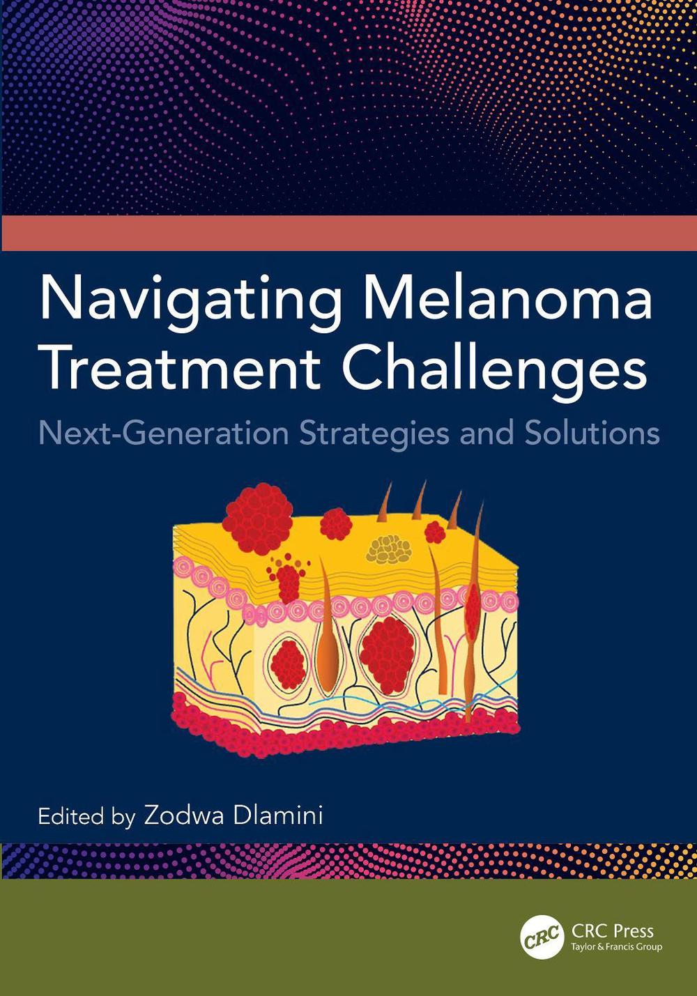 Navigating Melanoma Treatment Challenges by Zodwa Dlamini, Hardcover ...