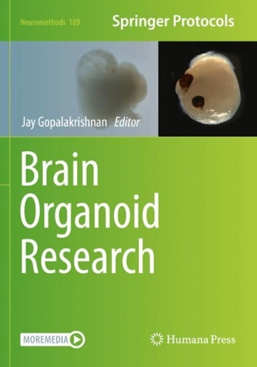 Brain Organoid Research, 2023rd Edition by Jay Gopalakrishnan ...