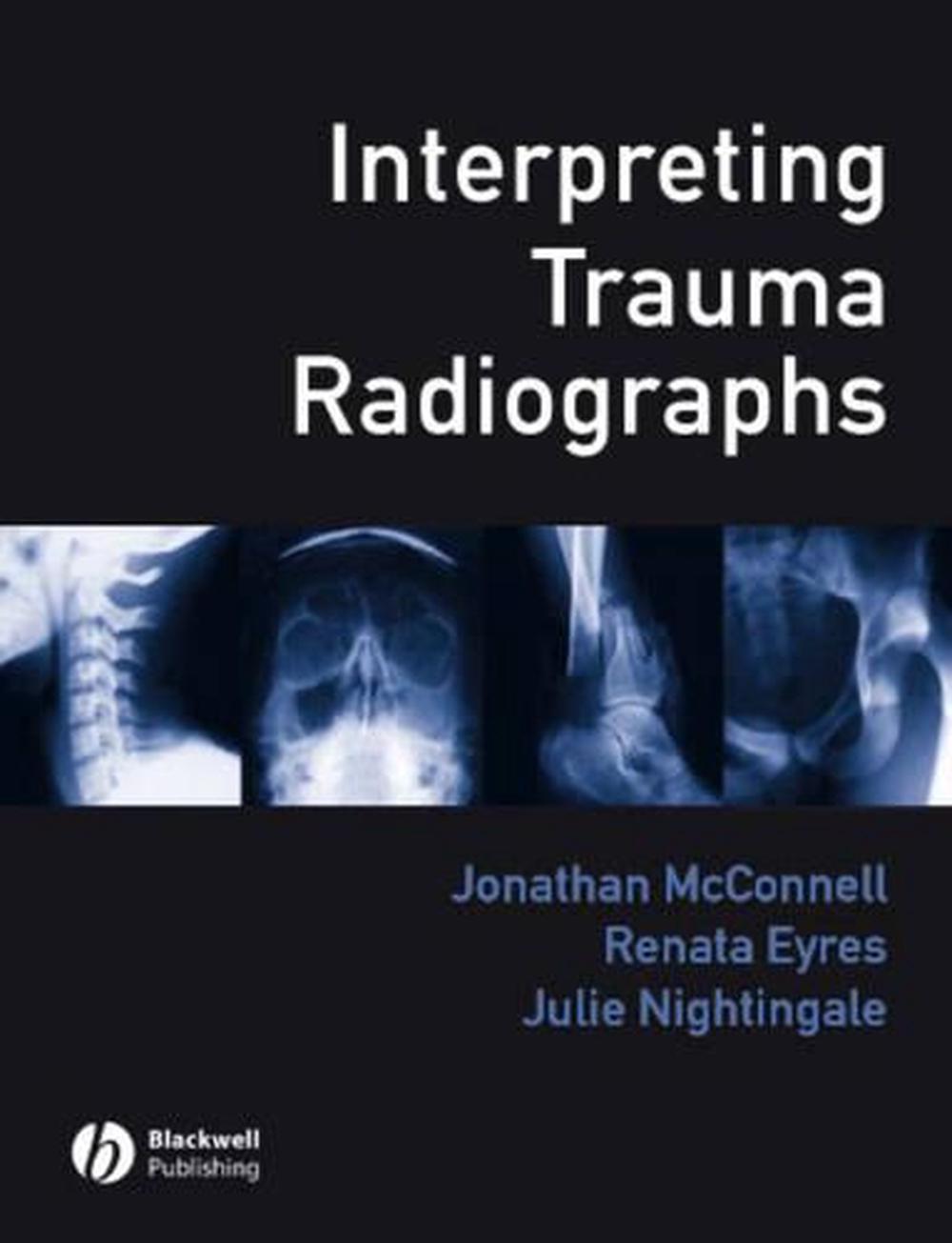 Interpreting Trauma Radiographs by Jonathan McConnell, Paperback ...