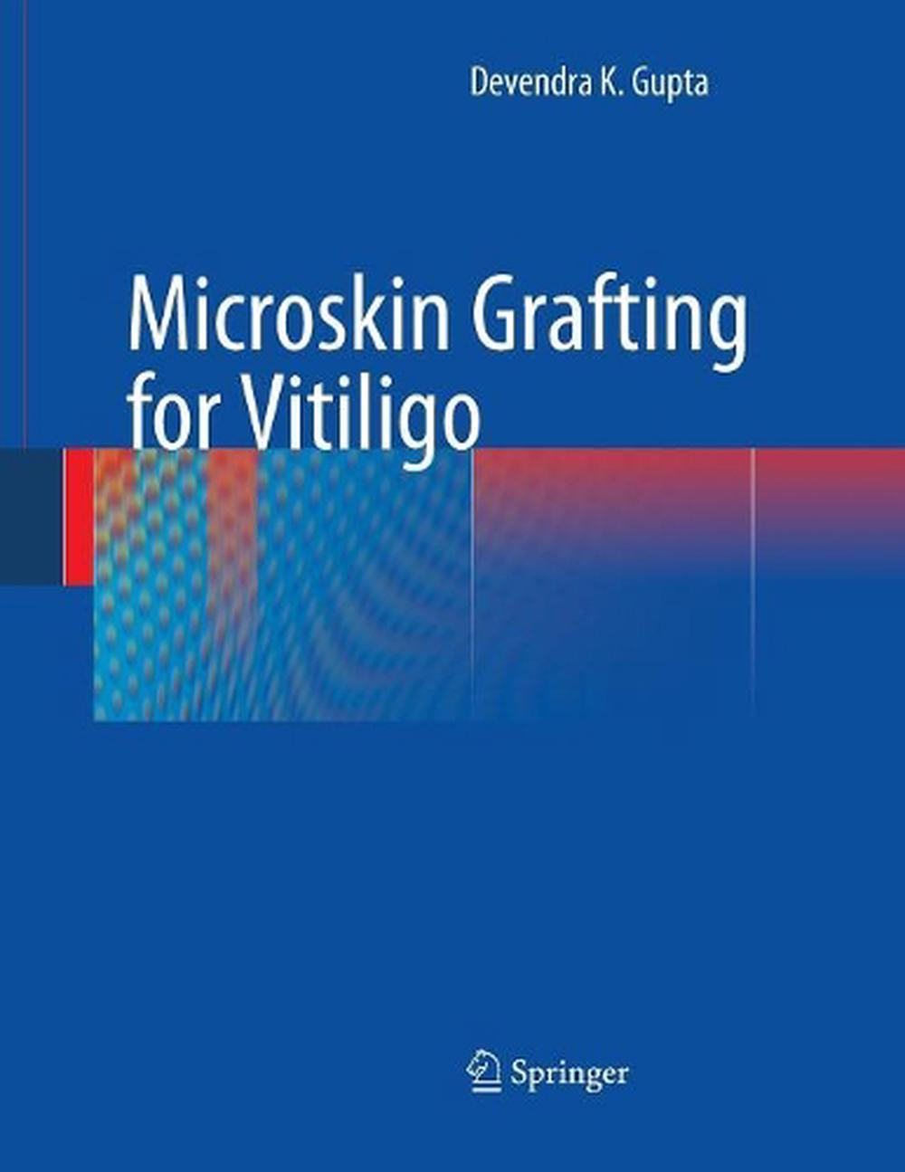 Microskin Grafting for Vitiligo by Devendra K. Gupta, Paperback ...
