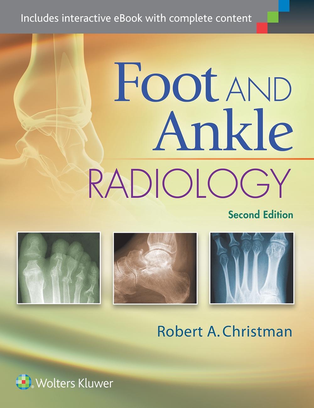 Foot and Ankle Radiology, 2nd Edition by Robert Christman, Hardcover ...