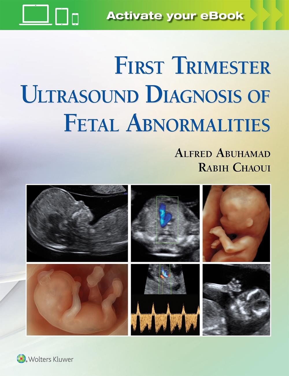 First Trimester Ultrasound Diagnosis of Fetal Abnormalities by Alfred Z ...