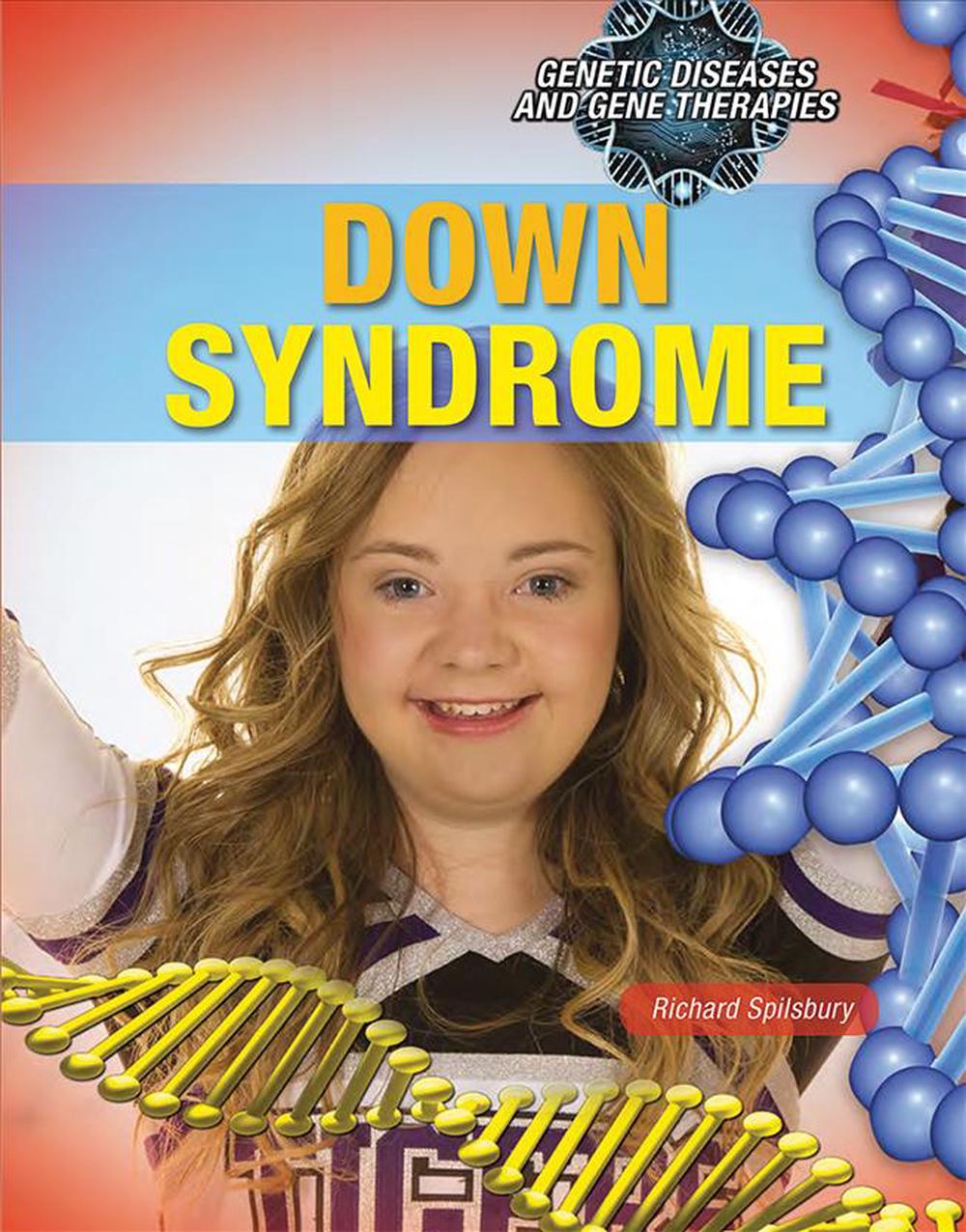 Down Syndrome by Richard Spilsbury, Hardcover, 9781508182801 | Buy ...