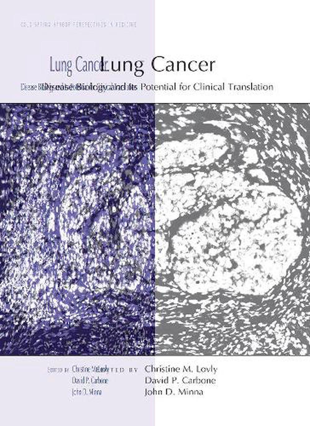 Lung Cancer: Disease Biology and Its Potential for Clinical Translation ...