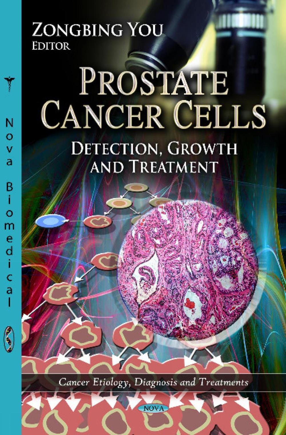 Prostate Cancer Cells by Zongbing You, Hardcover, 9781622575251 | Buy ...
