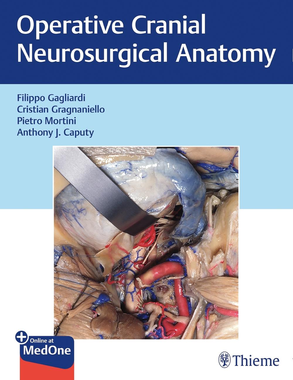 Operative Cranial Neurosurgical Anatomy by Filippo Gagliardi, Hardcover ...