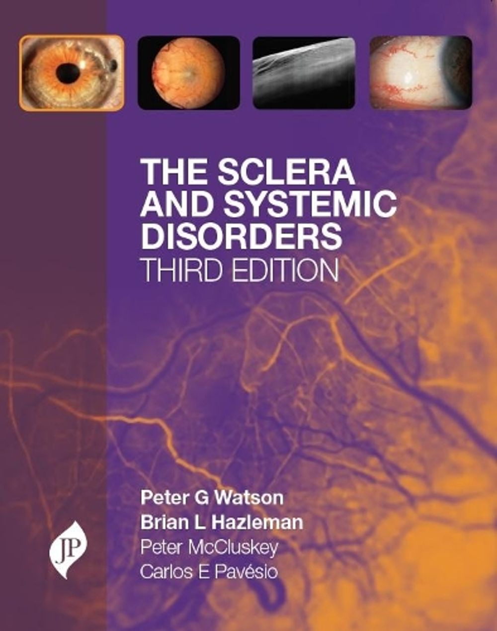 The Sclera and Systemic Disorders, 3rd Edition by Peter G. Watson ...