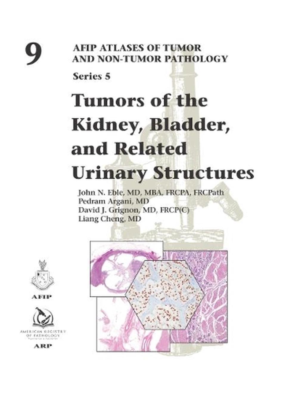 Tumors of the Kidney, Bladder, and Related Urinary Structures by Pedram ...