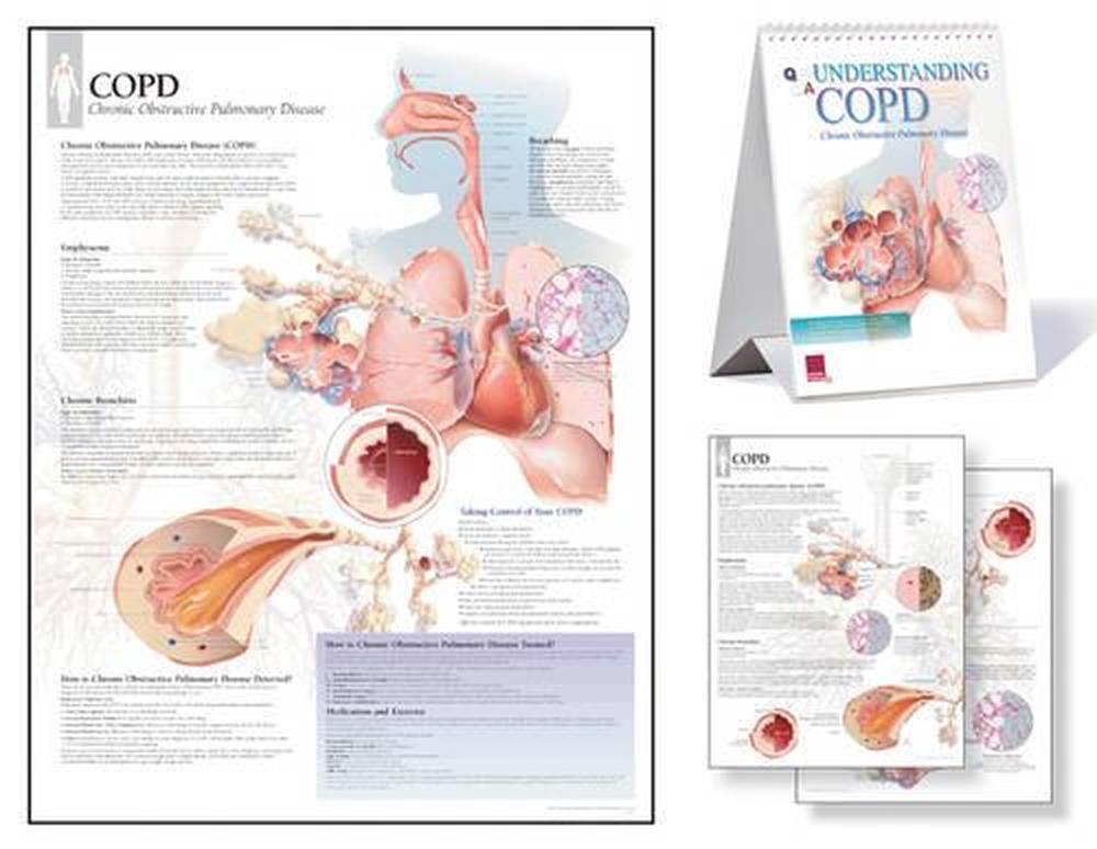 Understanding COPD Study Set by Scientific Publishing, Wall ...
