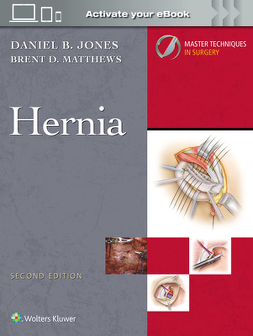 Master Techniques in Surgery: Hernia: Print + eBook with Multimedia ...