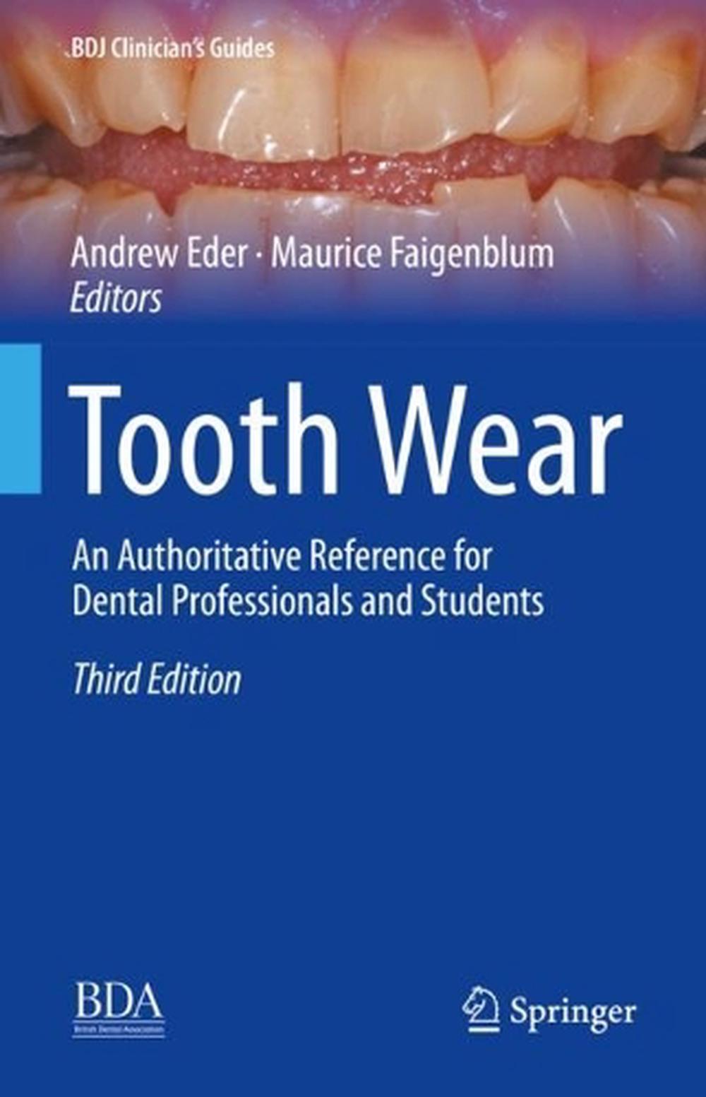 Tooth Wear by Andrew Eder, Hardcover, 9783030861094 | Buy online at The ...
