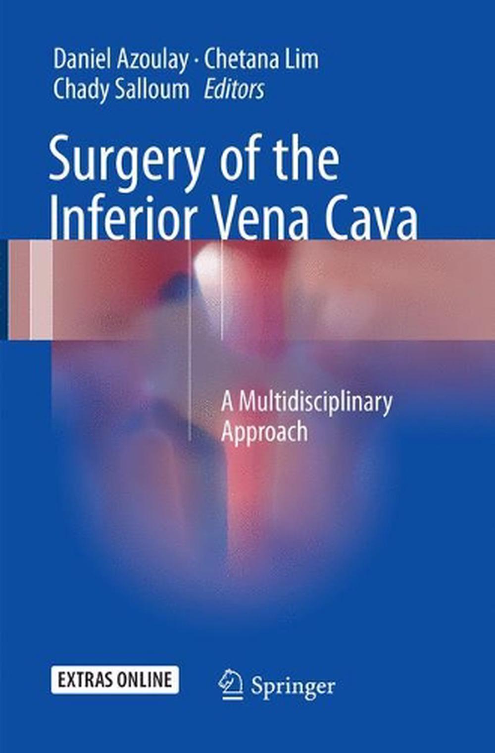 Surgery of the Inferior Vena Cava by Daniel Azoulay, Paperback, 9783319798103 | Buy online at ...