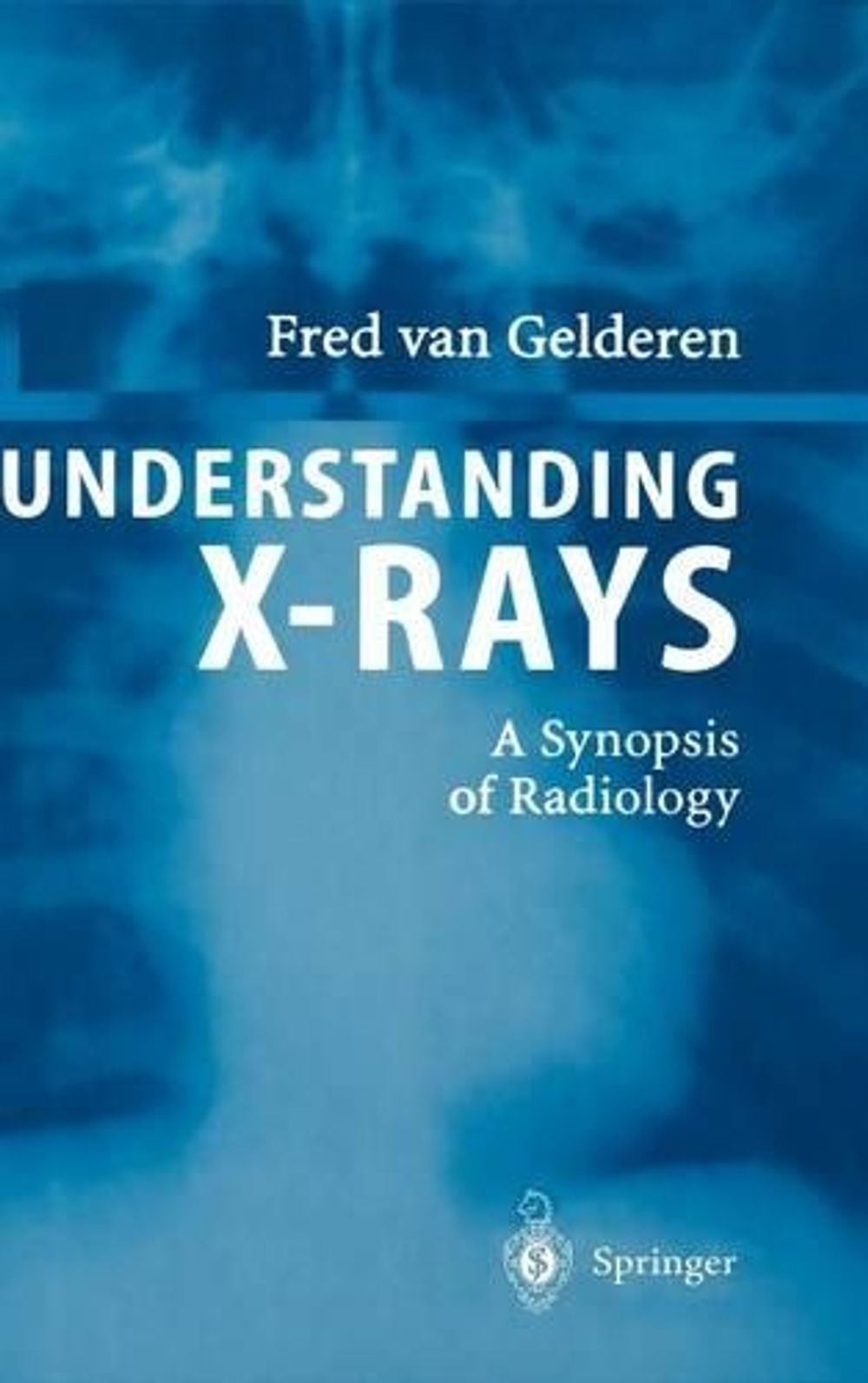 Understanding X-Rays, 2004th Edition by Fred van Gelderen, Hardcover ...