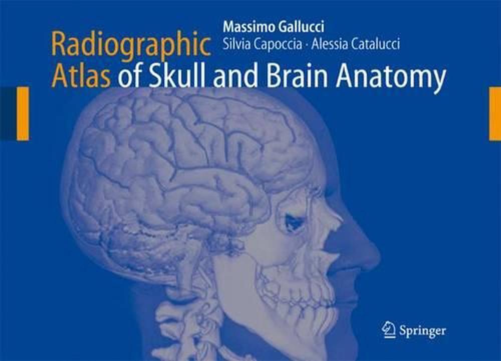 Radiographic Atlas of Skull and Brain Anatomy by Massimo Gallucci ...
