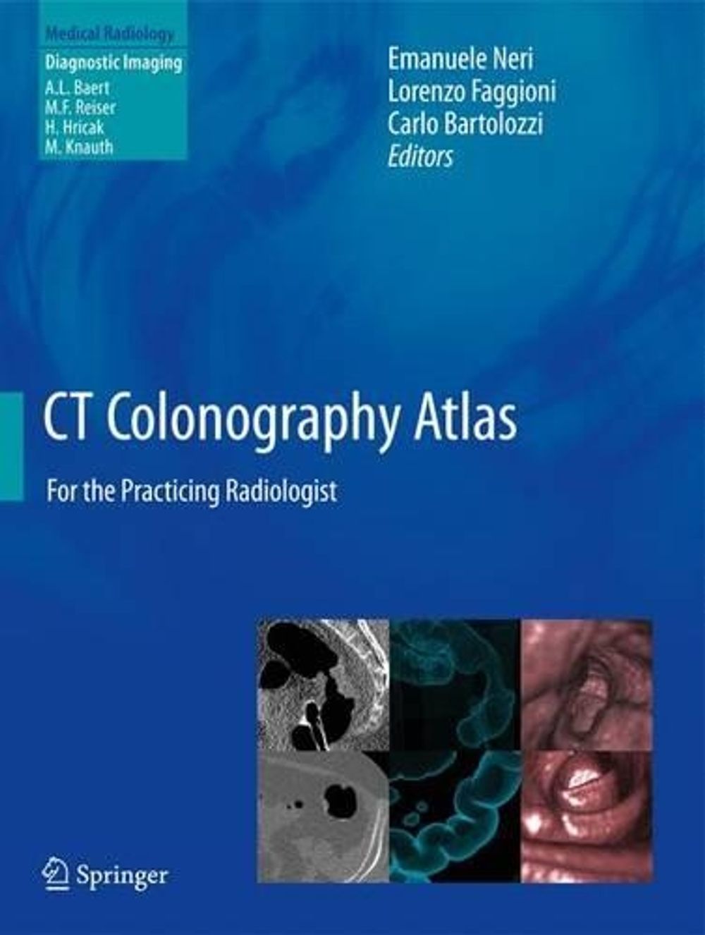 CT Colonography Atlas by Emanuele Neri, Hardcover, 9783642111488 | Buy ...