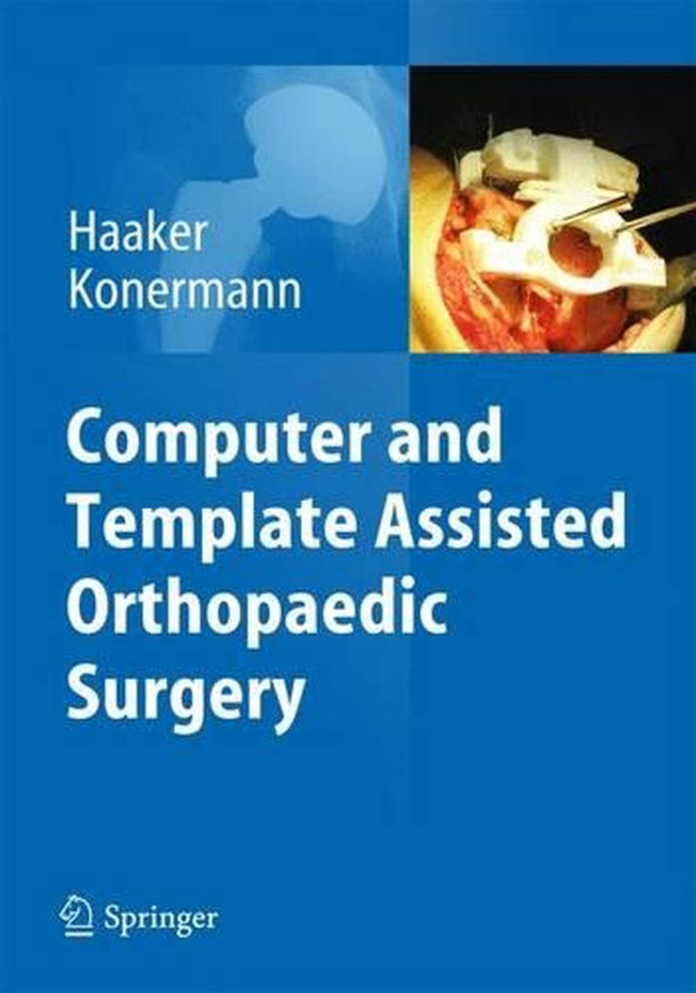 Computer and Template Assisted Orthopedic Surgery by Rolf Haaker ...