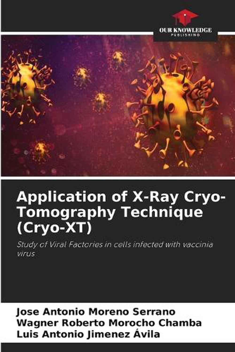 Application of X-Ray Cryo-Tomography Technique (Cryo-XT) by Jose Antonio Moreno Serrano ...