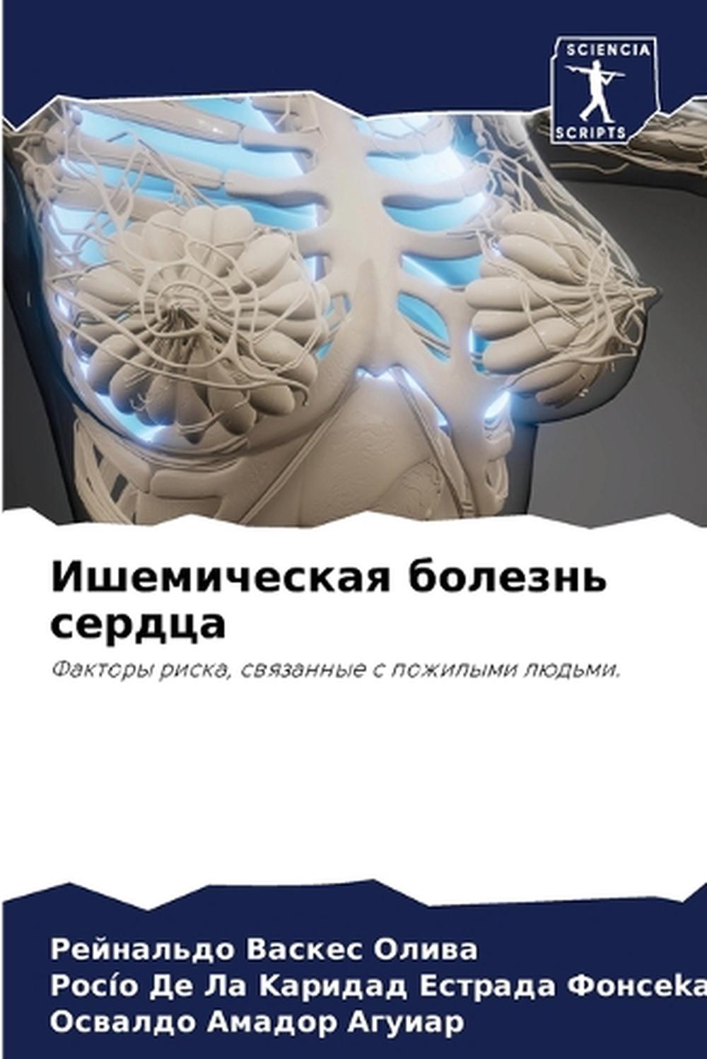 Ишемическая болезнь сердца by Рейналь Васкес Олива, Paperback ...