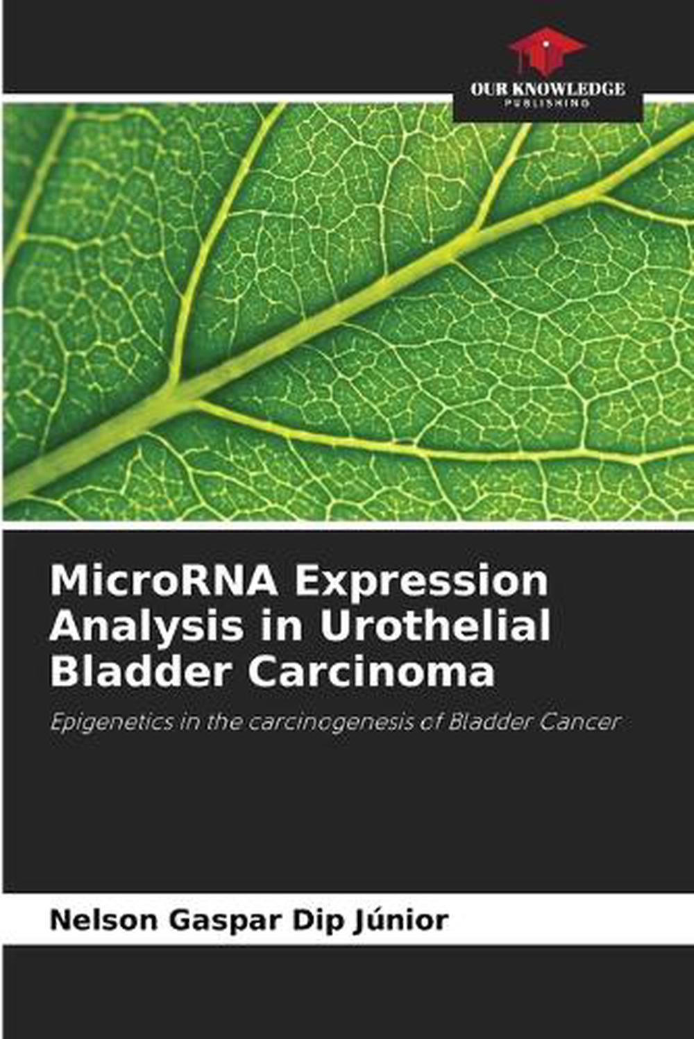 MicroRNA Expression Analysis in Urothelial Bladder Carcinoma by Nelson Gaspar Dip Júnior ...