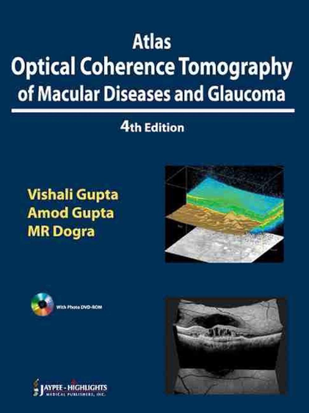 Atlas Optical Coherence Tomography of Macular Diseases and Glaucoma by ...