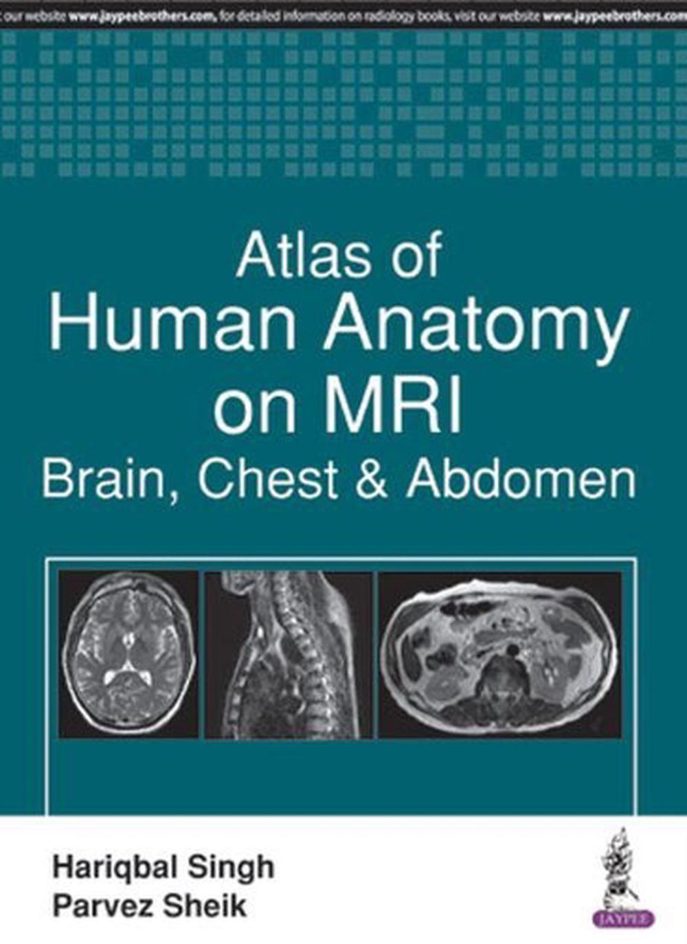 Atlas of Human Anatomy on MRI by Hariqbal Singh, Paperback ...