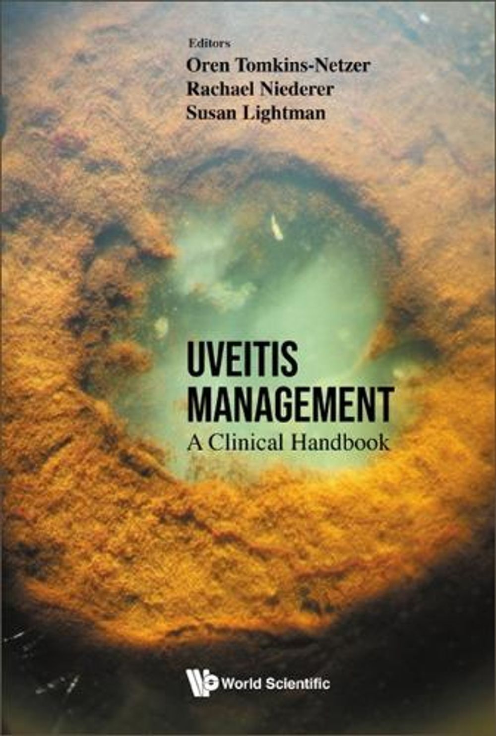 Uveitis Management: A Clinical Handbook by Rachael Niederer, Hardcover ...